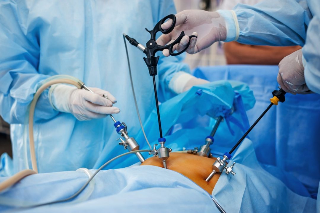Hernies de la paroi - Dr Pierre Allemann - Chirurgie